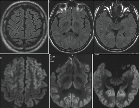 Untitled Document [www.jneuro.com]